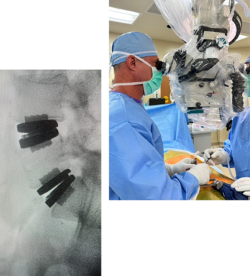 Artificial Disc Replacement Paducah, KY - K. Brandon Strenge, M.D.